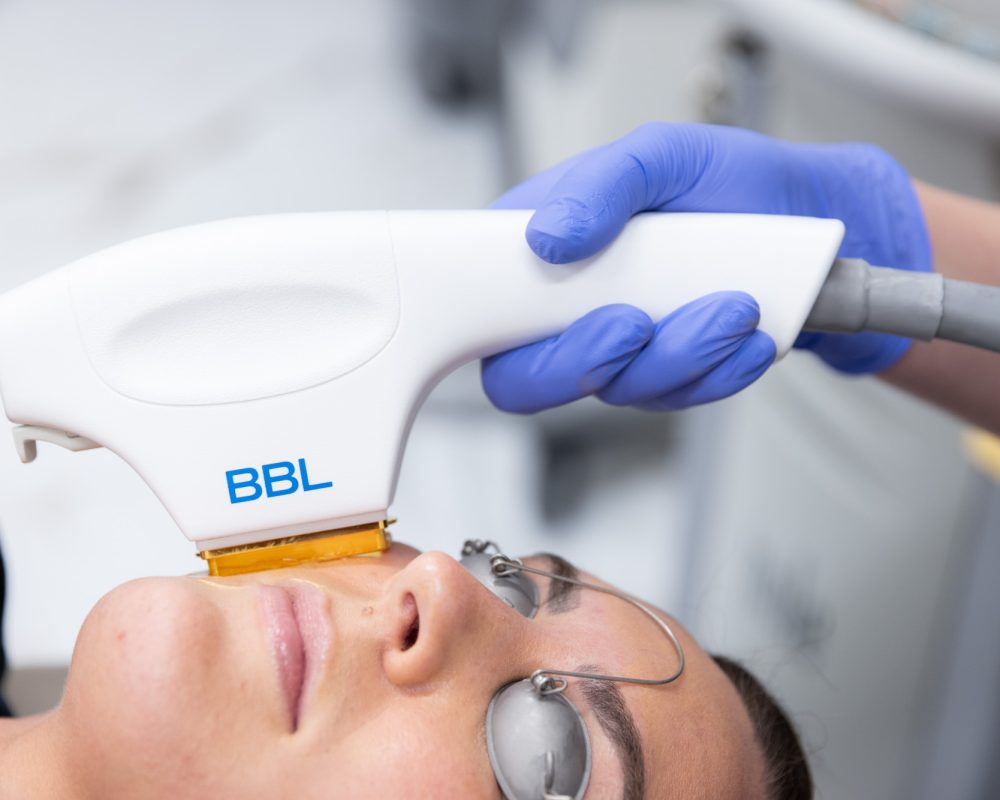 Laser - Dr. Sara Dickie Plastic & Reconstructive Surgery